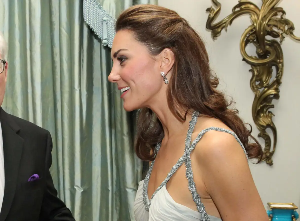 El origen de la cicatriz que Kate Middleton tiene en la cabeza: la ...