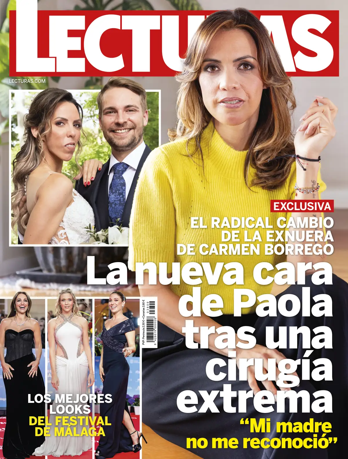 EXCLUSIVA | La nueva cara de Paola Olmedo tras una cirugía extrema: el ...
