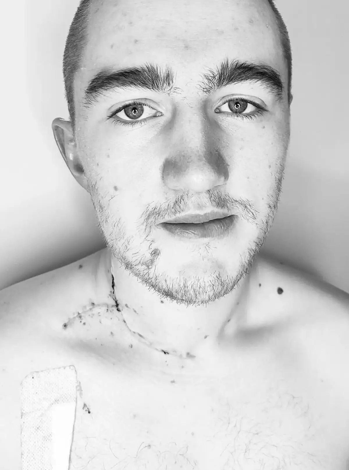 Finnian Garbutt, actor de 'Hope Street', anuncia que padece un cáncer ...